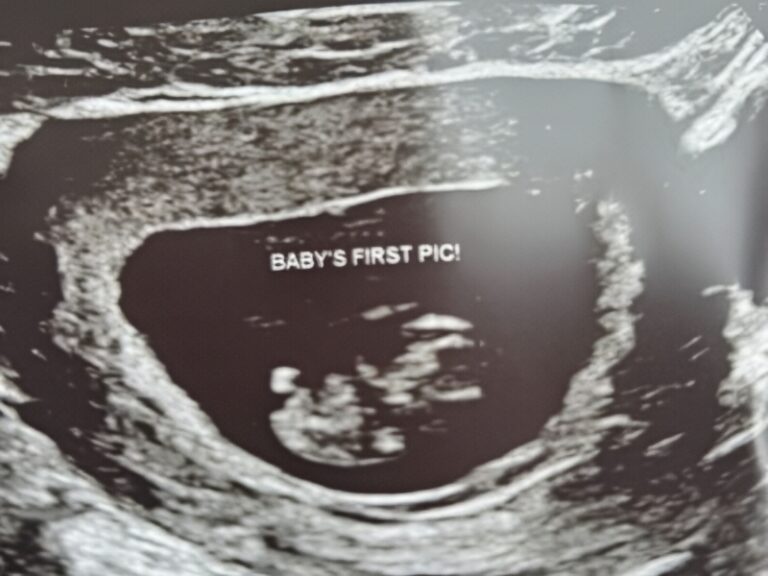 Rain Brown Pregnant! ABP's Ami Brown Announces Baby News